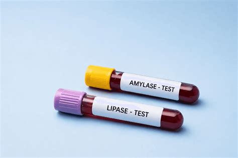 How To Talk To Your Doctor About Expanded Lab Panels Levels Levels