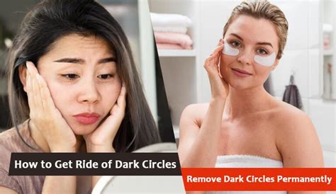 How To Get Rid Of Dark Circles Remove Dark Circles Permanently