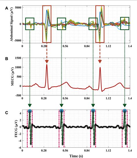 Figure 1 From A Deep Learning Framework For Noninvasive Fetal Ecg