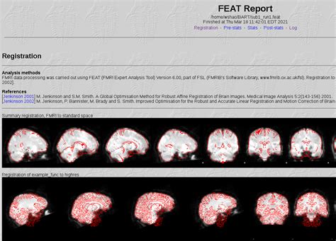Preprocessing — Weis Menu For Neuroimage 001 Documentation