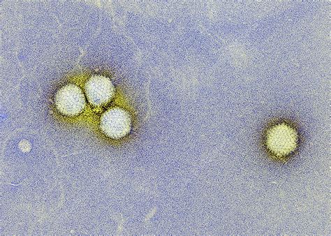 Adenovirus Particles Tem Stock Image C0288695 Science Photo Library