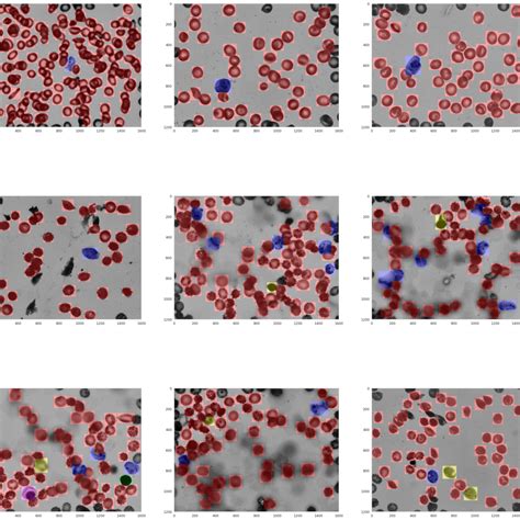 Malaria Bounding Boxes Kaggle