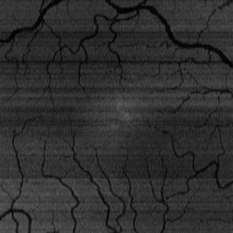Enface Oct Images Obtained In A Healthy Subject The Layers Are As