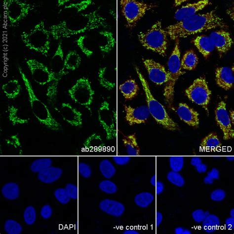 Atpb抗体[10 Atp] Mitochondrial Marker Ab289890 Abcam中文官网
