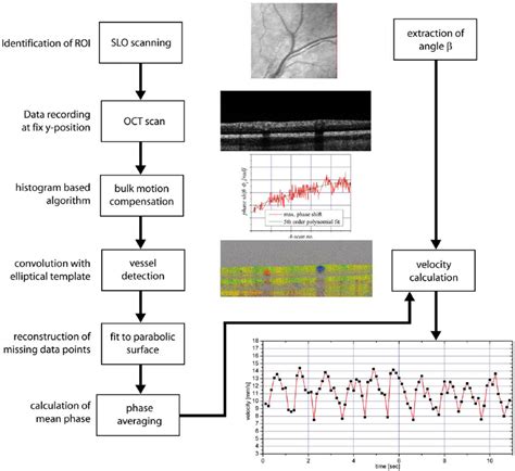 Flow Chart For Bidirectional Doppler Fd Oct Flow Chart Explaining