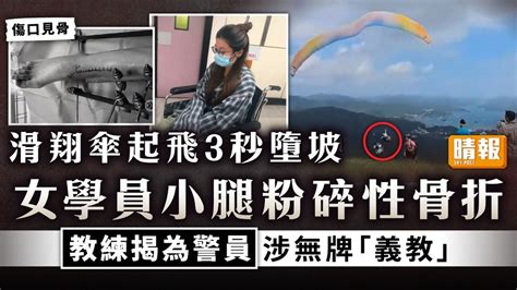滑翔傘意外｜起飛3秒墮坡 女學員小腿粉碎性骨折 教練揭為警員涉無牌「義教」