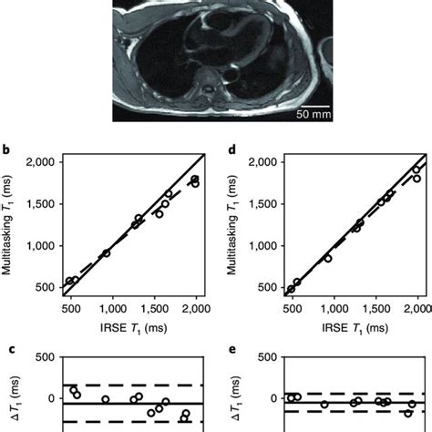 Non Cartesian Sampling Spiral And Radial A Spiral K Space Trajectory Download Scientific