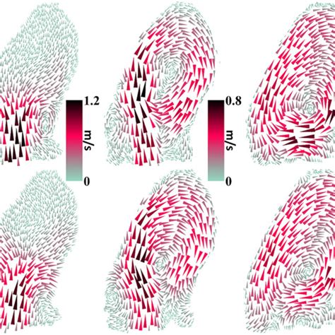 Analysis In The Patient Specific Cfd Heart Model Comparison Of The Download Scientific Diagram