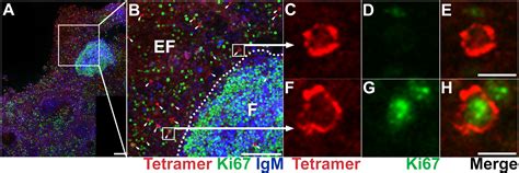 Video In Situ Mhc Tetramer Staining And Quantitative Analysis To Determine The Location