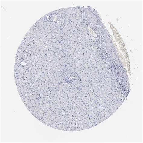 Tissue Expression Of Slc1a2 Staining In Liver The Human Protein Atlas