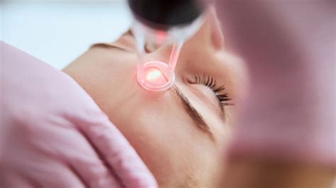 PICO LASER Laser Dengan Teknologi Terkini E3A Clinic