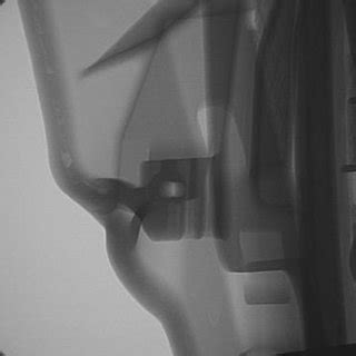 Two X Ray Images Showing Some Defects Present During The Manufacturing Download Scientific