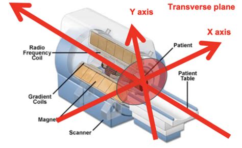 Mri Flashcards Quizlet