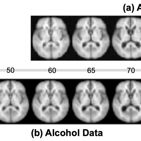 A Brain Age Of 274 Normal Control Subjects From The Alcohol Dataset Download Scientific