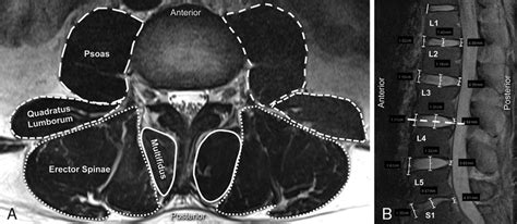 Cervical Paraspinal Muscles Anatomy
