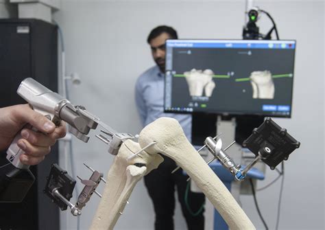 360 computer vision navigation surgical system good design
