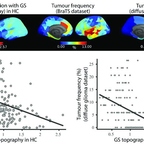 Spatial Correlation Between Gs Topography And Tumour Frequency A Gs