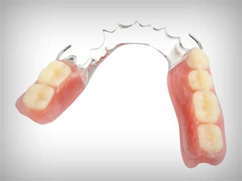 Denture Information Saskatoon Denture Clinic