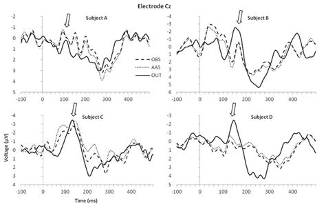 N1 Event Related Potential Waveforms At Electrocardiography Site Cz Download Scientific Diagram
