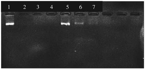 Gel Picture Of Plasmid Dna Eluted With Elution Buffer 3 Provided With Download Scientific