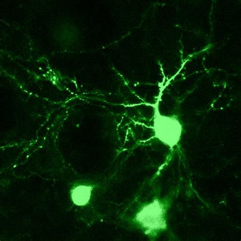 Нейроны мозга рассмотрели по слоям Наука и жизнь