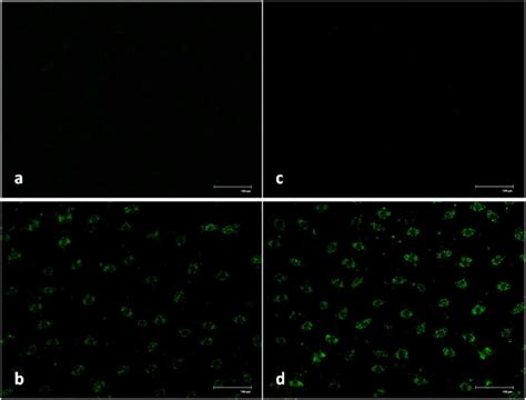Real Time Detection Of No No Production In Leaf Epidermal Cells Was