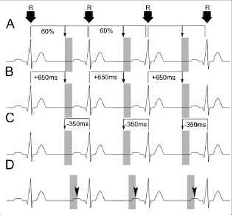 Retrospective Ecg Gating Techniques In The Figure Different Approaches Download Scientific