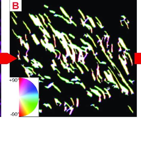 Brief Illustration Of Image Fiber Analysis Covering A Qualitative