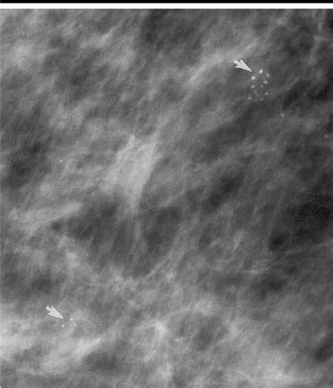 Graph Shows A Z Values For Each Participant As Compared With The Download Scientific
