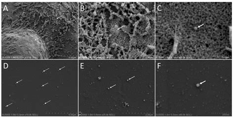 Scanning Electron Microscopy Of Sars Cov 2 Like Particles A C Download Scientific Diagram