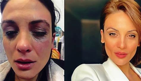 Диана Димитрова е дала обяснения в полицията след твърденията за нанесен побой