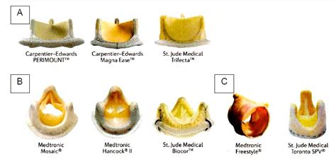 Précis Danesthésie Cardiaque 6 1152 Heart Valve Prostheses