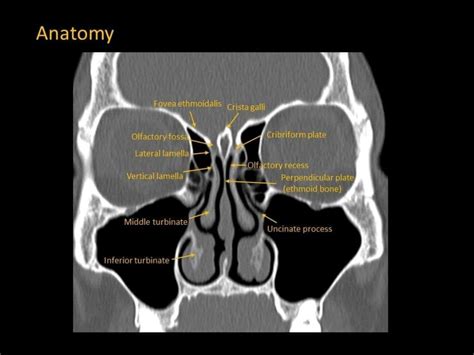 Dr Mati Ul Haq Posted On Linkedin