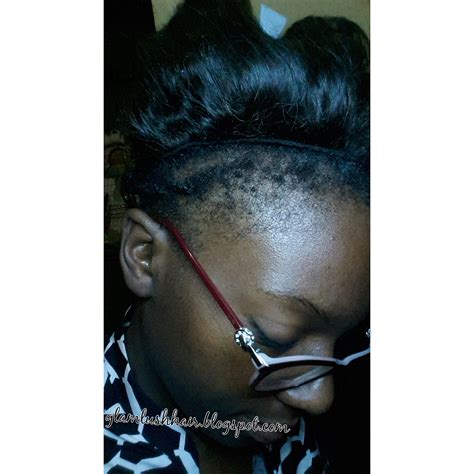 Glam Lush Hair For Sensitive Edges How To Weave And Keep Your Hairline