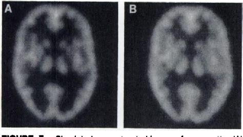 Figure 7 From Three Dimensional Spect Simulations Of A Complex Three Dimensional Mathematical