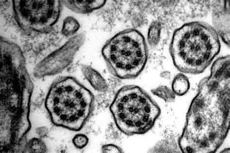 26 Facts About Cilia