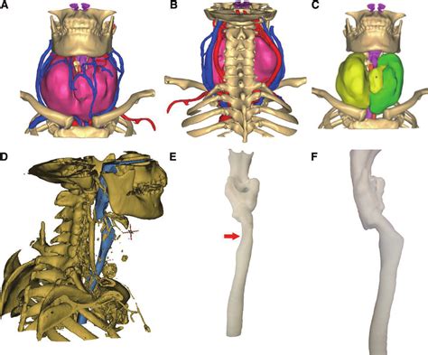 Three Dimensional Reconstruction Model And 3d Printing Model A C The