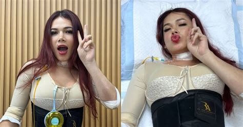 La Uchulú Sorprende Con Nuevas Operaciones Estéticas “me Operé La