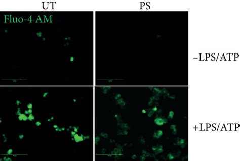 Ps Inhibit The Lps Atp Induced Nlrp3 Inflammasome By Downregulating Er
