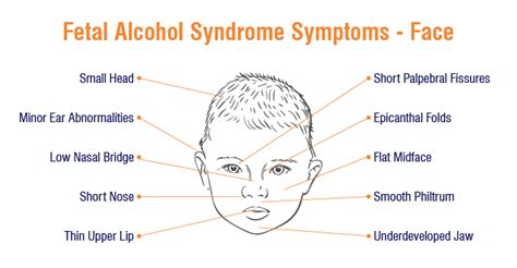 Alcohol Use Pregnancy Deformity