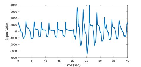 Output Of Windowing Algorithm For An Epoch Labelled Possibly