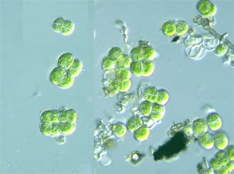 Protist Images Desmococcus
