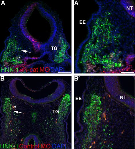 Morpholino Mediated Depletion Of αn Catenin Increases The Migratory