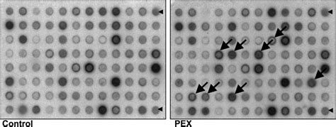 Differential Screening Of Subtracted Cdna Libraries Approximately 8500 Download Scientific
