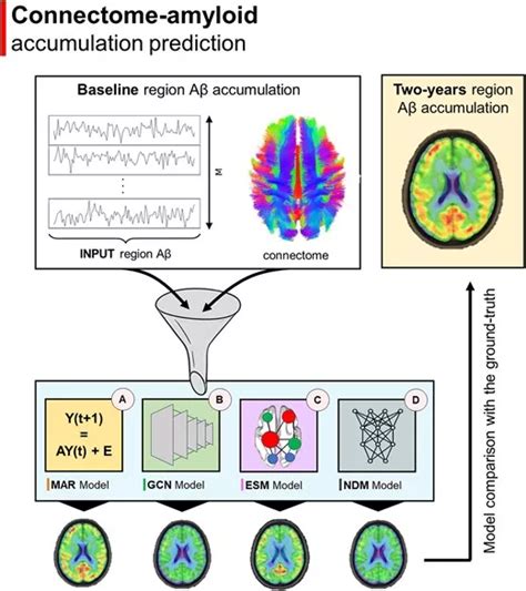 A Breakthrough In The Accuracy Of Prediction Of The Course Of Alzheimer