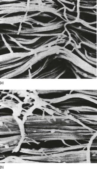 Connective Tissue Clinical Gate