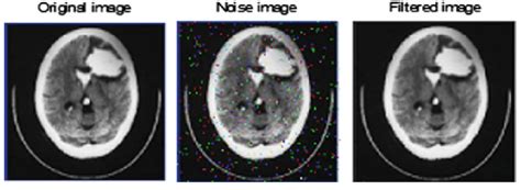 Resulted Images Using Median Filter Download Scientific Diagram