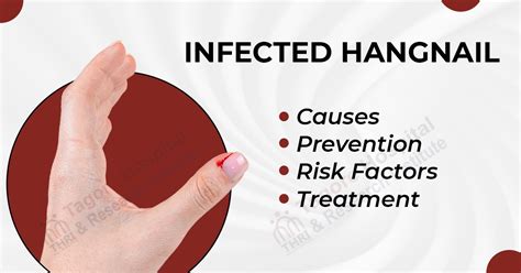 Infected Hangnail Causes Prevention Risk Factors And Treatment