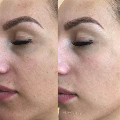 Bb Glow Training Hd Beauty Academy