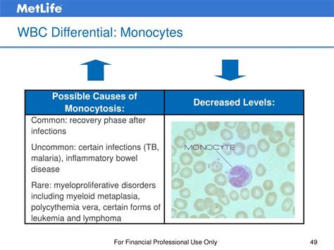 Cbc Differential Monocytes At Sally Esterly Blog